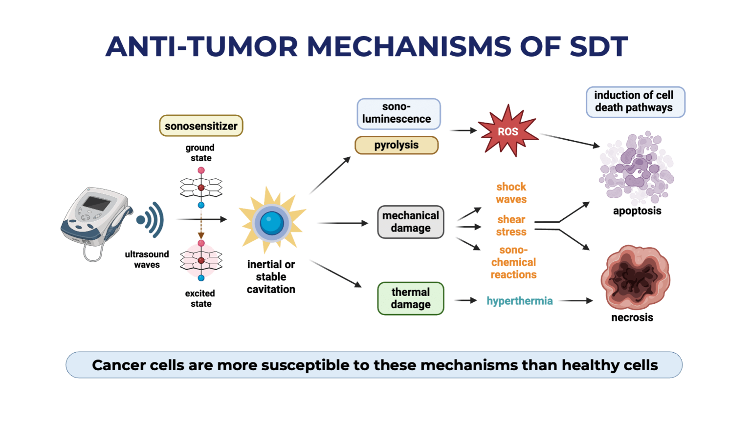 TREATING CANCER WITH SOUND WAVES: AN OVERVIEW OF SONODYNAMIC THERAPY ...